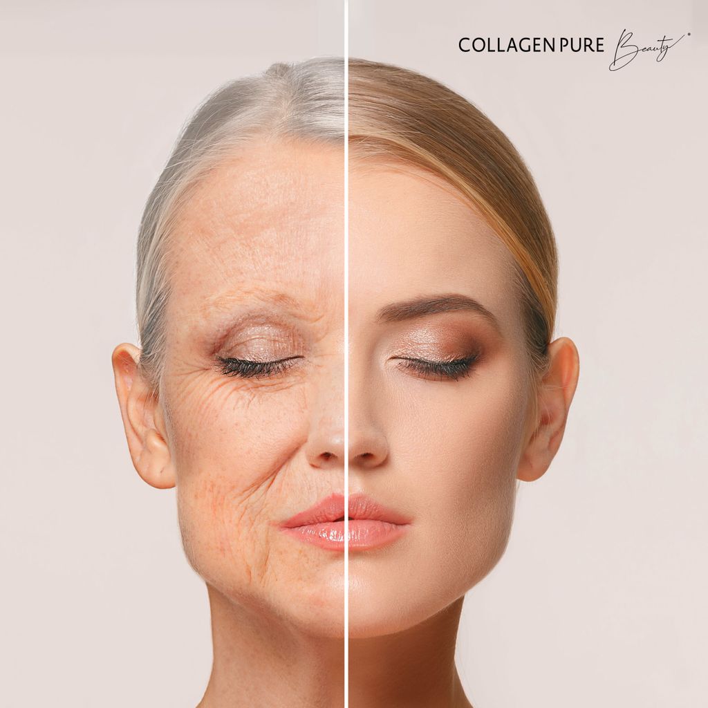 COLLAGEN PURE Beauty | Hochdosiert mit 10g | | Kaufland.de