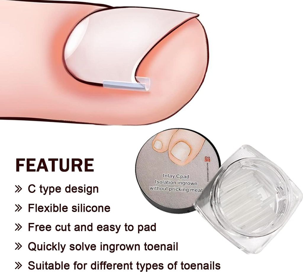 Das Kit zur Korrektur eingewachsener | Kaufland.de