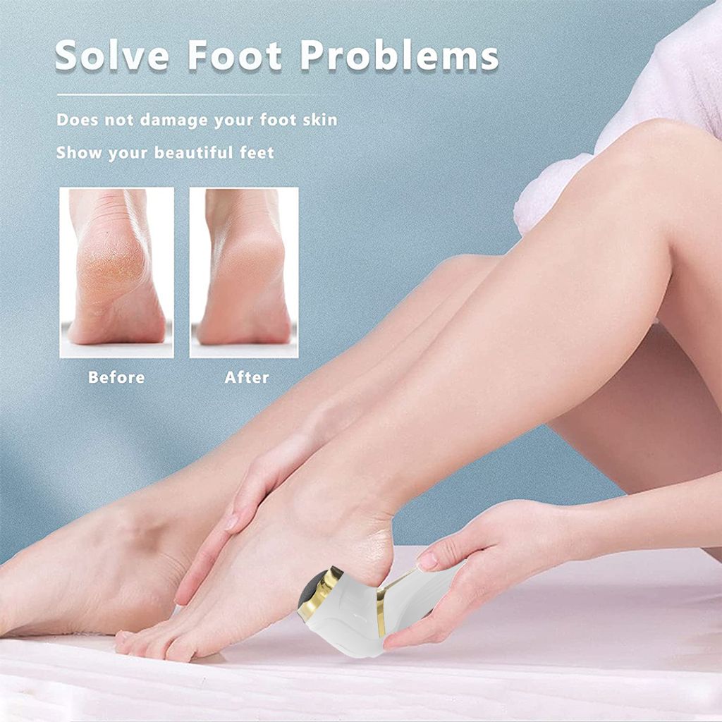 Elektrický odstraňovač mozoľov na chodidlách, | Kaufland.sk