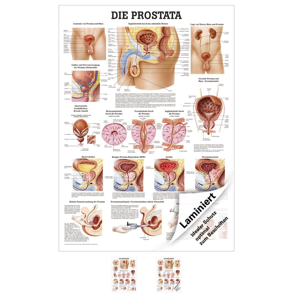 Die Prostata Lehrtafel Anatomie 100x70 cm | Kaufland.de