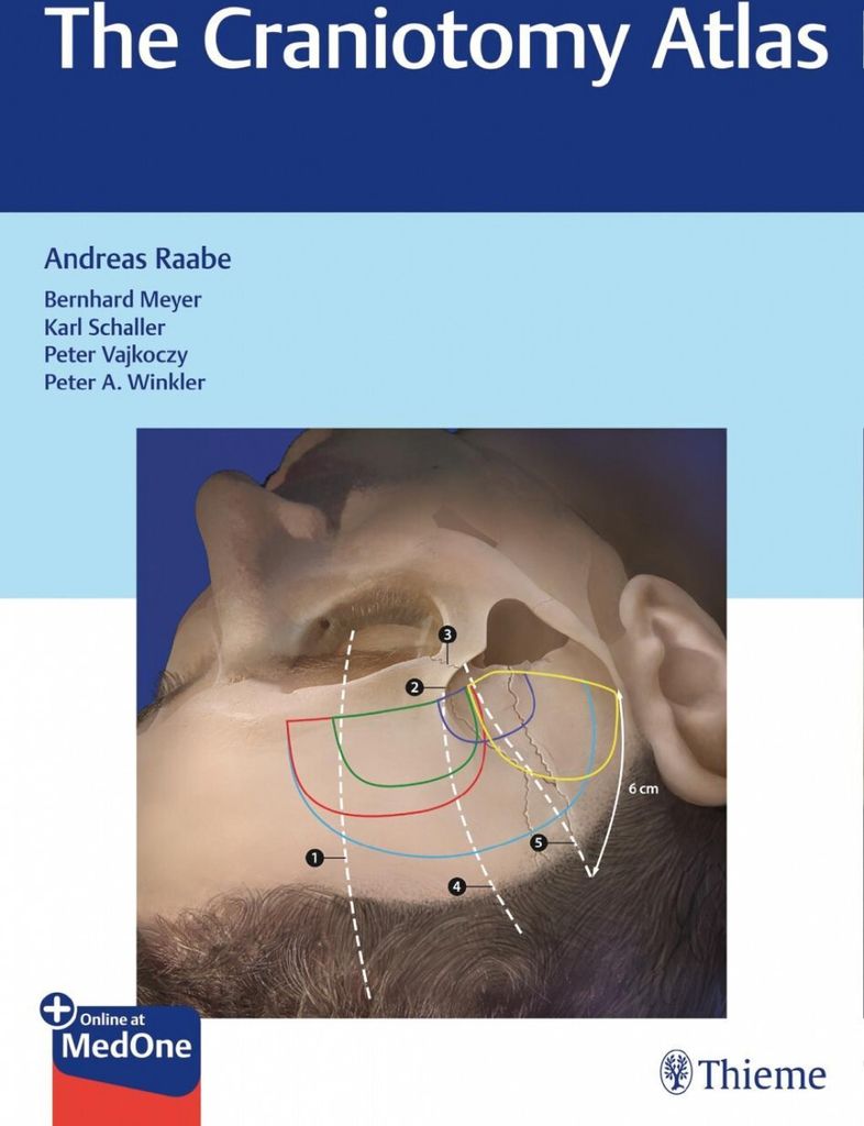 The Craniotomy Atlas | Kaufland.de